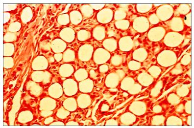 Biomedical Open Access Journal For Medical and Clinical Research ...