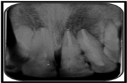 Figure 10b: 6 months follow-up.
