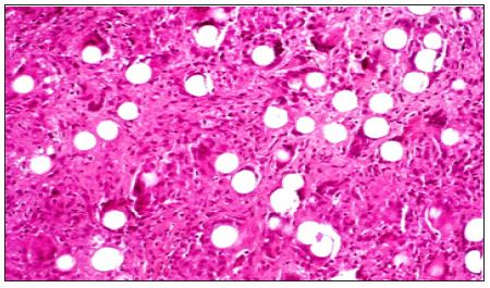 Biomedical Open Access Journal For Medical and Clinical Research ...