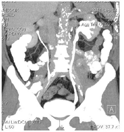 Figure 4: Another example of free passage of the contrastthrough the ...